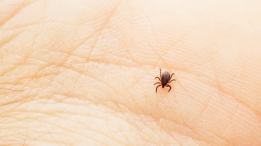 Fièvre pourprée des montagnes Rocheuses | «C'est une infection qu'on ...